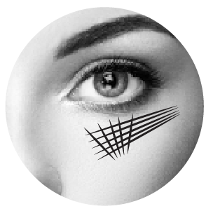 PDO Threads: Under Eye | Zero Gravity Aesthetics and Wellness
